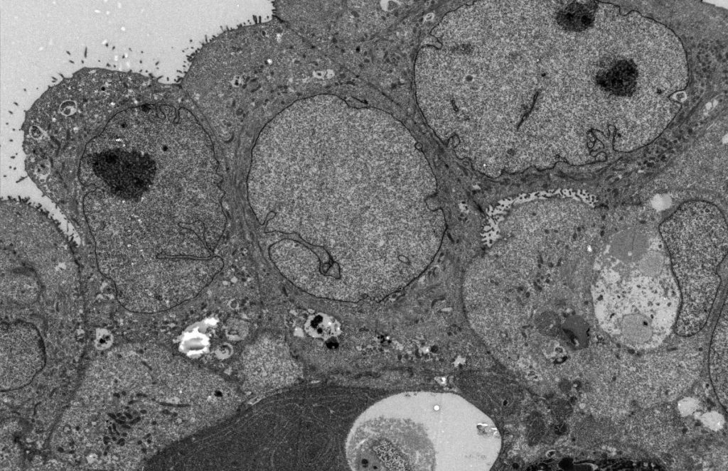 Electron Microscopy Suite