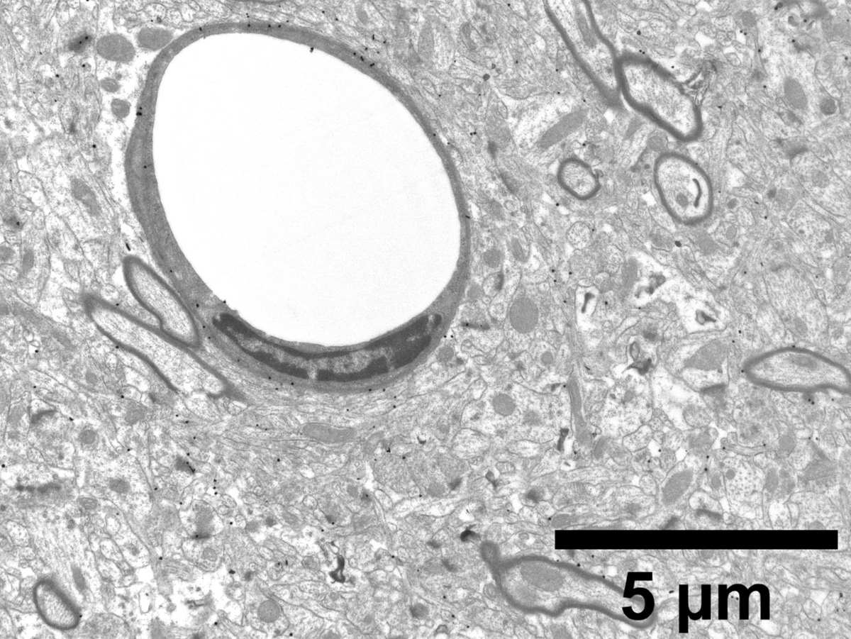 Electron Microscopy Suite