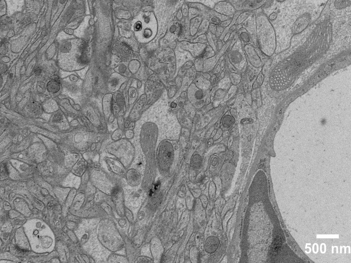 Electron Microscopy Suite