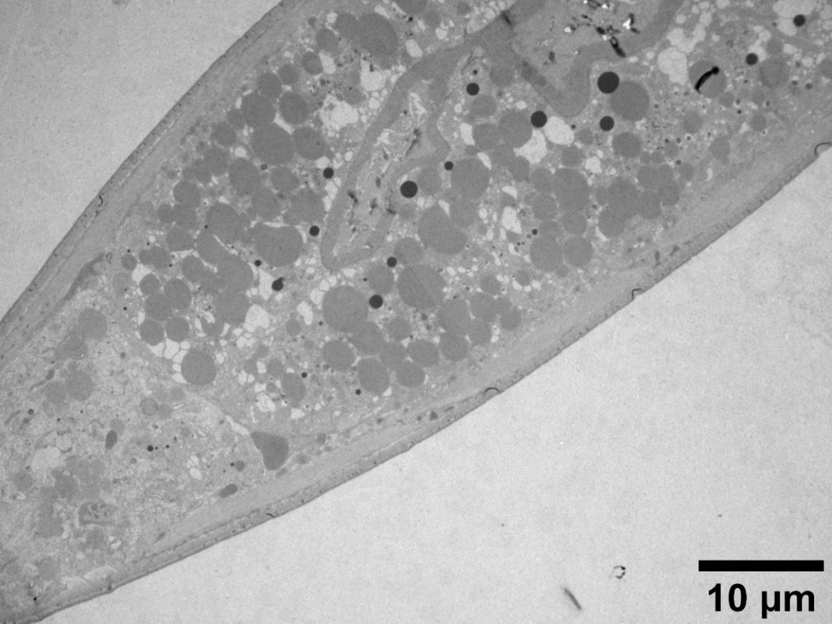 Electron Microscopy Suite